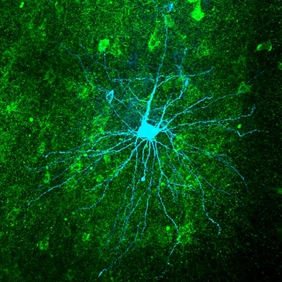 Tye Laboratory – Systems Neuroscience Research